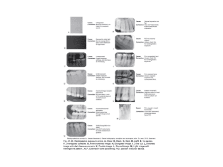Dental X-ray Refresher Course - Academy for Dental Assistants