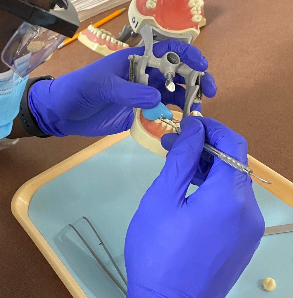 How to Pour a Study Model as a Dental Assistant